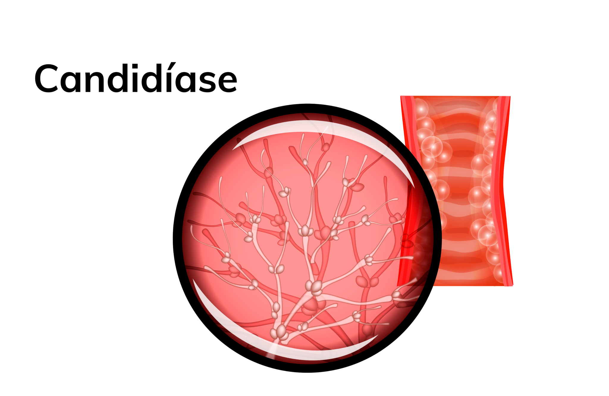 Micoses | Descubra os tipos mais comuns e saiba como evitar